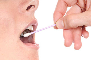 AMD-macular-degeneration-dna-test-cheek-swab - Eye Concepts of Santa Monica